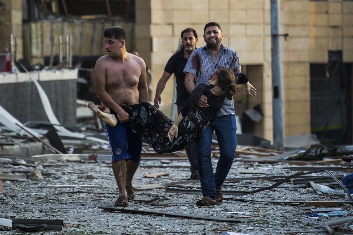 Hassan Ammar, Hussein Malla and Felipe Dana of Associated Press - The ...